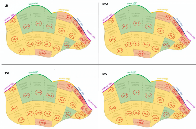 Say Hi to the Transfemoral Socket Pressure Map – Socket Sense